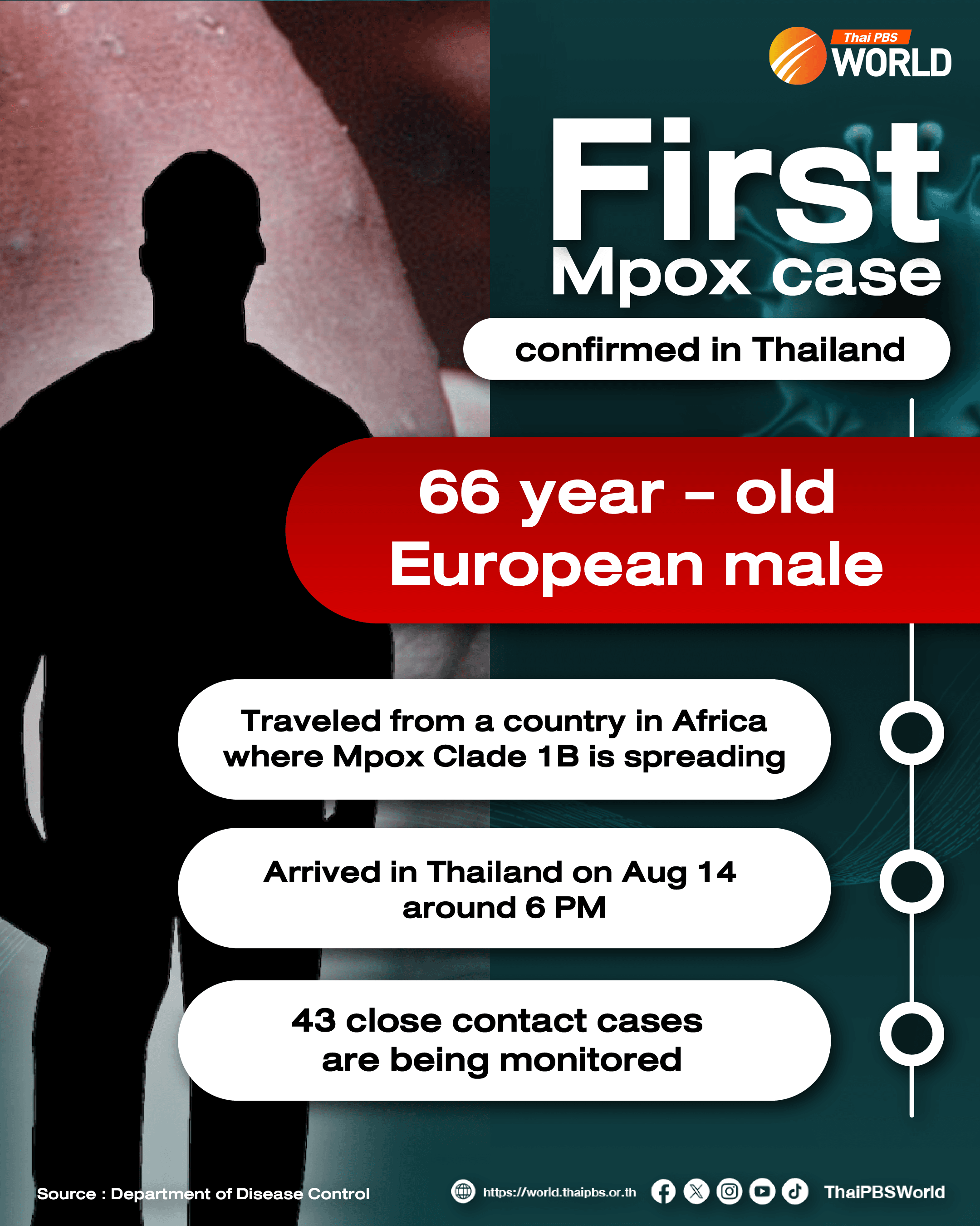 First Mpox case confirmed in Thailand